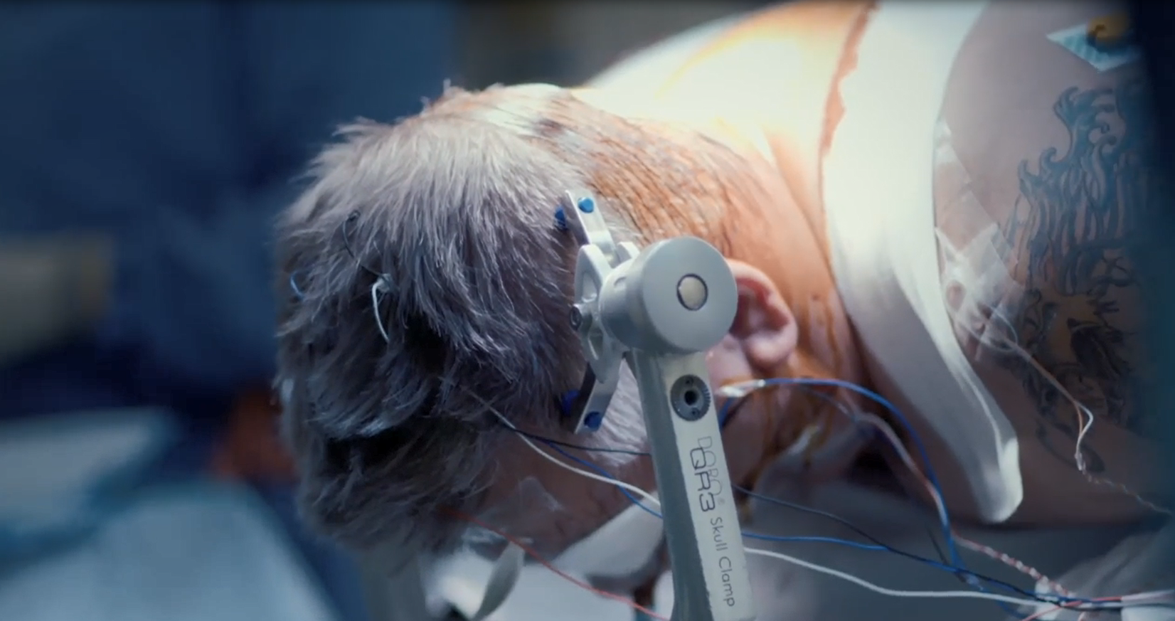 Series 3 | University Hospitals of North Midlands